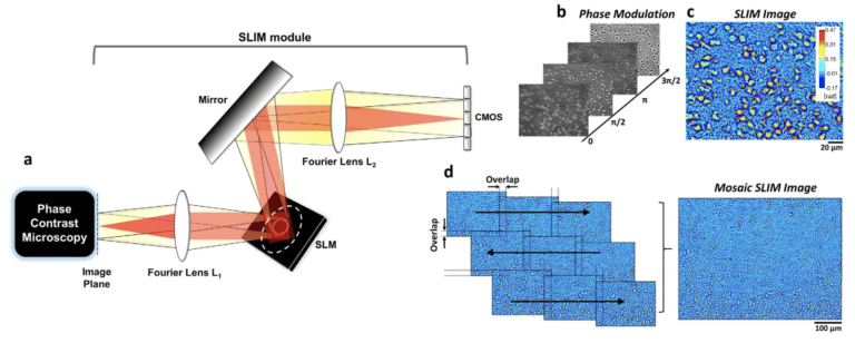 Label Free Multi Scale Imaging Of Ex Vivo Mouse Brain Using Spatial Light Interference