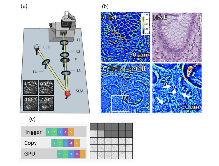 Label-free Tissue Scanner for Colorectal Cancer Screening; Journal of ...