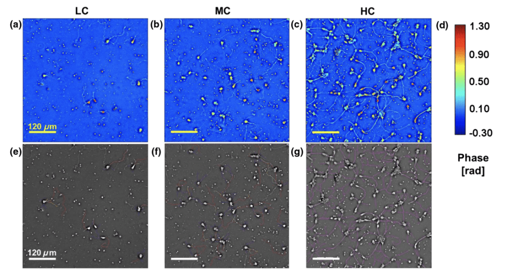 Quantitative Assessment of Neural Outgrowth using Spatial Light ...