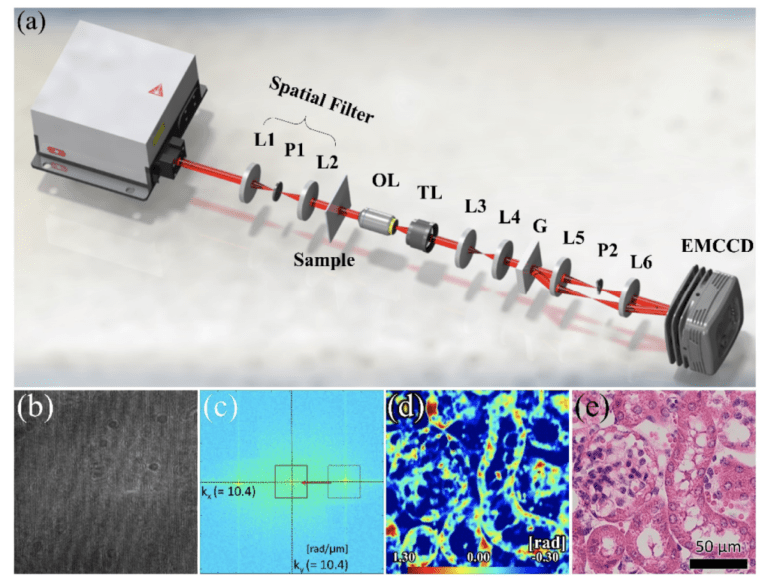 Optical Properties of Acute Kidney Injury Measured by Quantitative ...