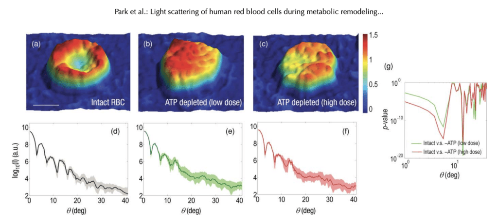 Light Scattering of Human Red Blood Cells During Metabolic Remodeling of the Membrane; J. Biomed ...