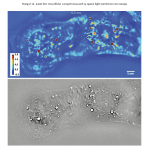 Label-free Intracellular Transport Measured by Spatial Light ...