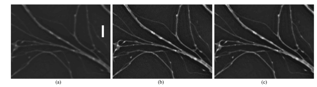 Deconvolved Spatial Light Interference Microscopy for Live Cell Imaging; IEEE Trans. Biomed. Eng ...
